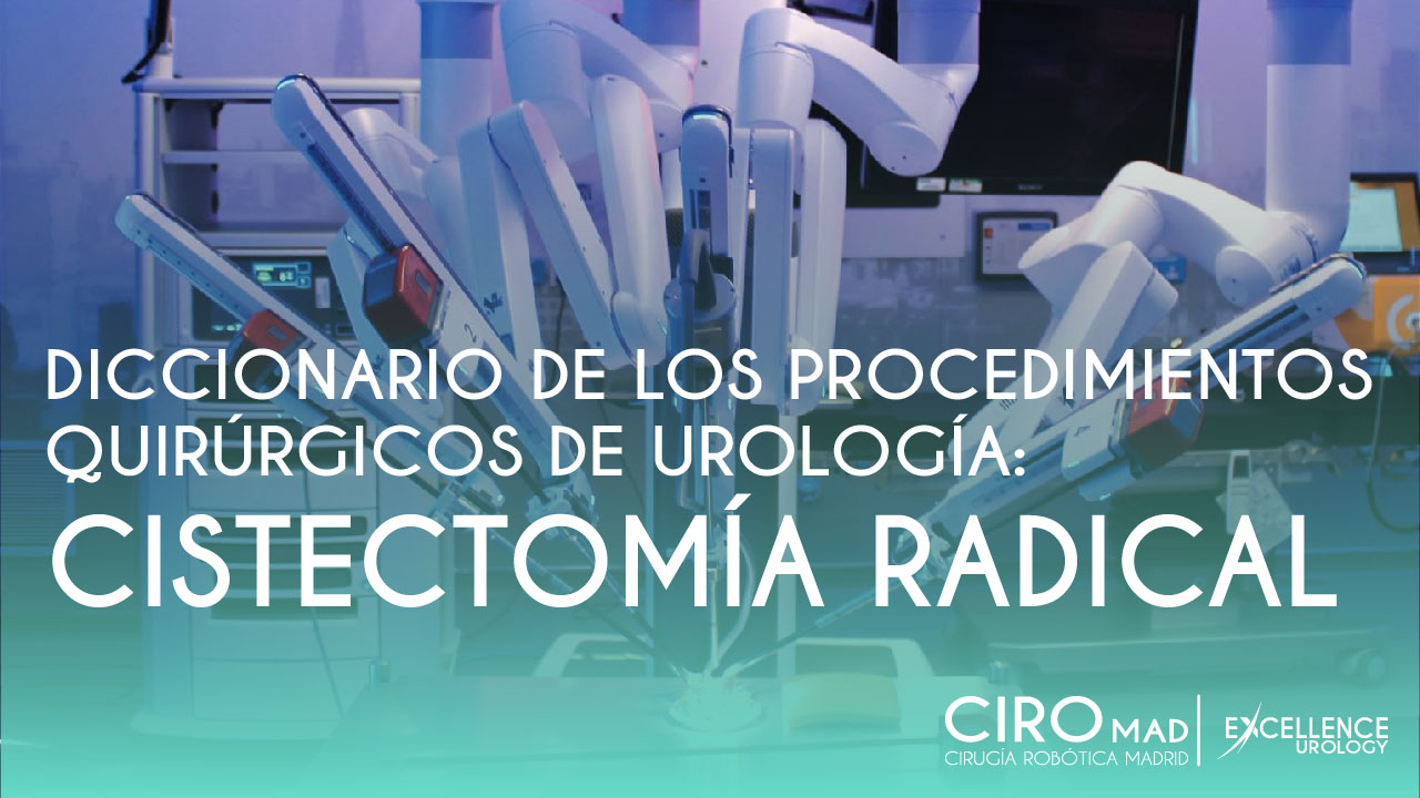 Cirugía Robótica: Cistectomía Radical - Excellence Urology